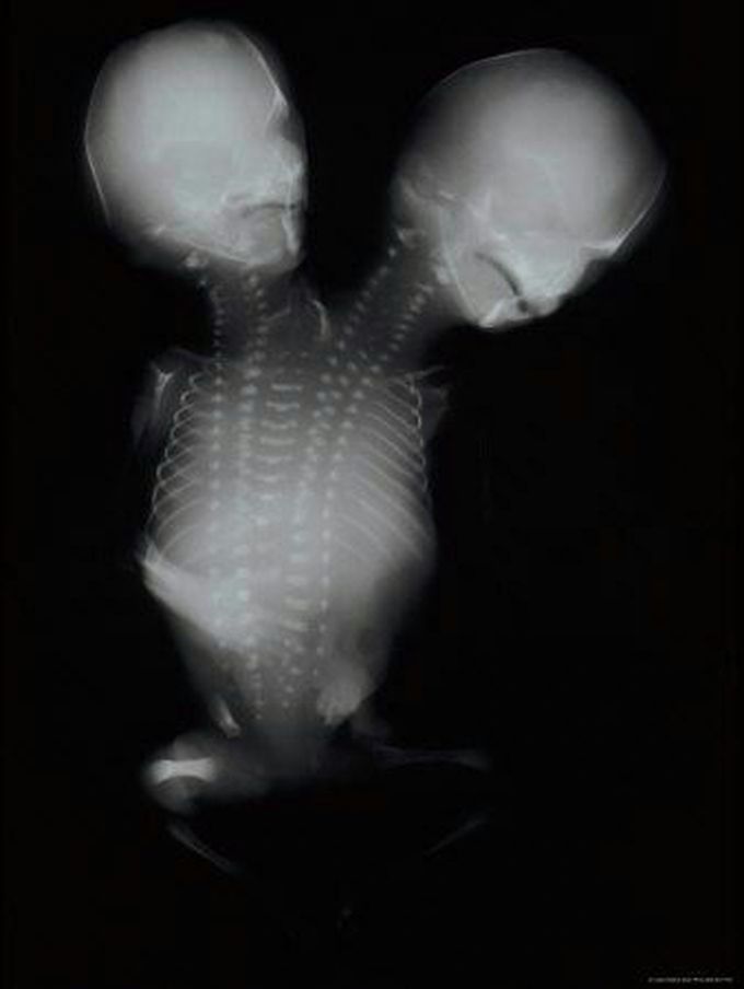 Post number 39382 - MEDizzy