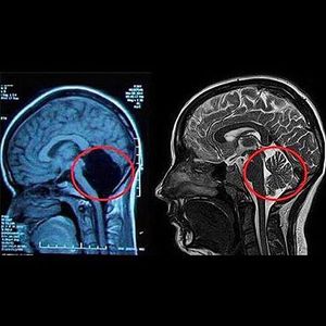 Careful, brain is missing? Well, it's an unrealistic TRUE - MEDizzy