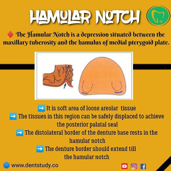 Hamular Notch Anatomy For Complete And Partial Dentures Ppt Download