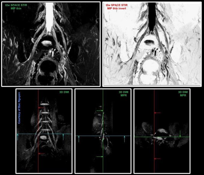 Plexus Imaging @ Siemens 3T Prisma#Siemens_MRI #mri #plexus - MEDizzy
