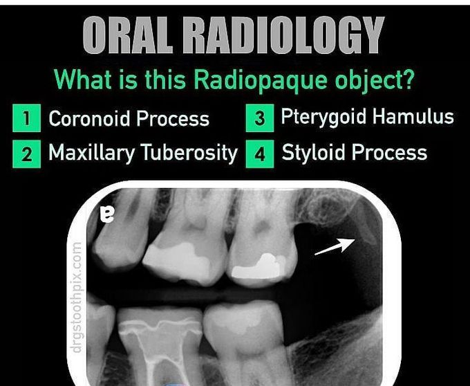 Hamulus Radiograph