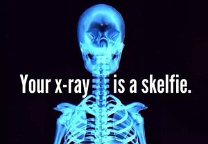 X-ray - MEDizzy