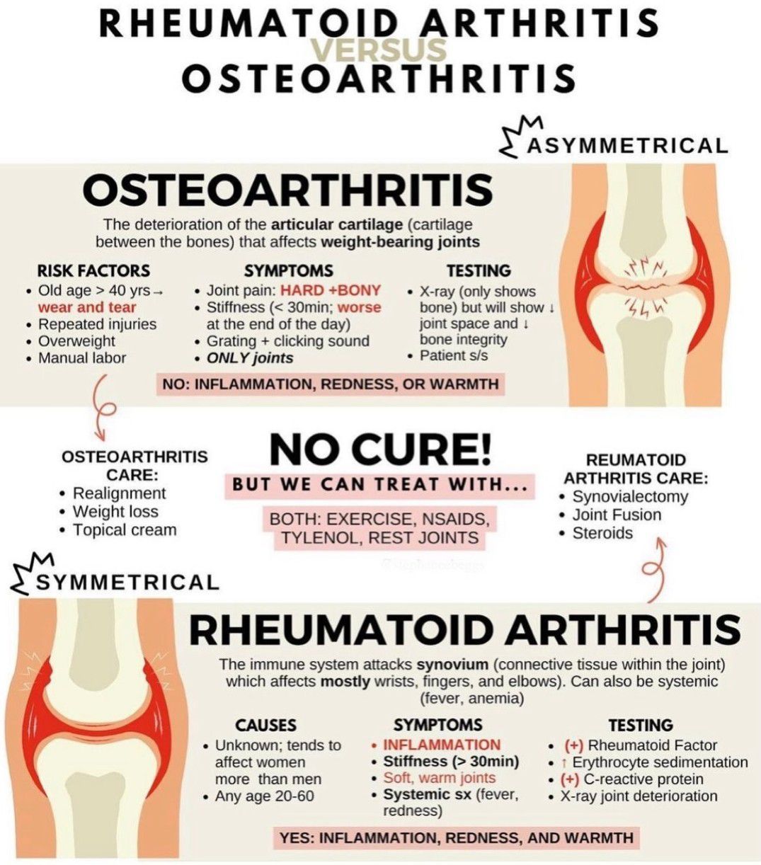Rheumatoid Arthritis Vs Osteoarthritis MEDizzy