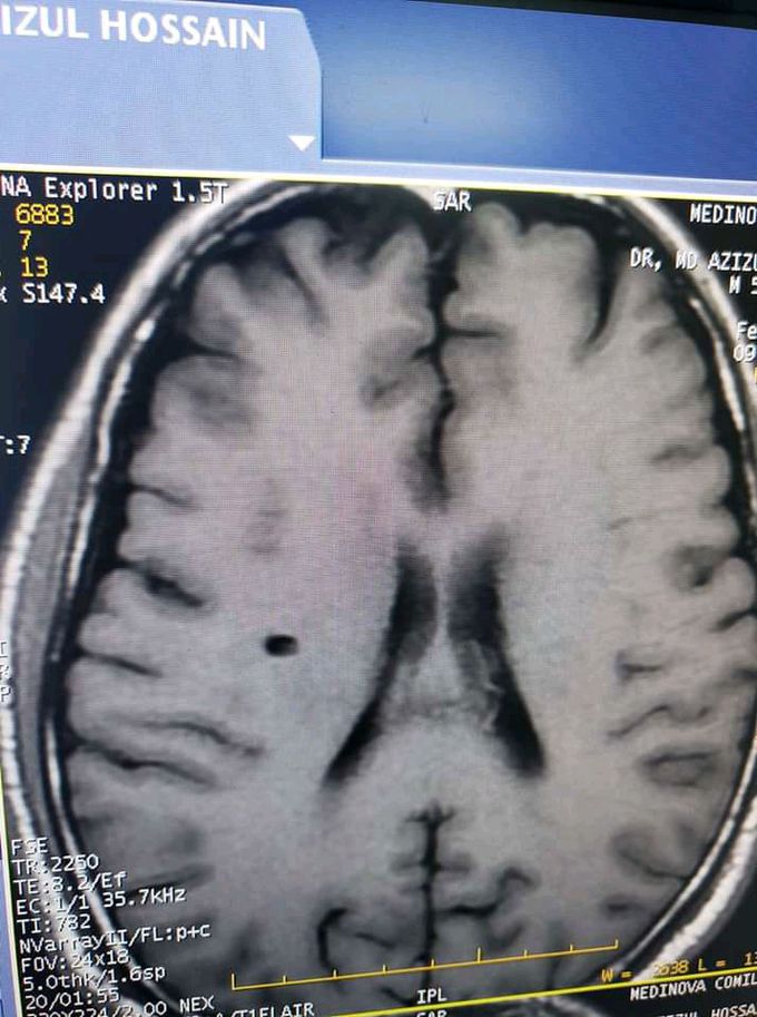 MRI REPORT - MEDizzy