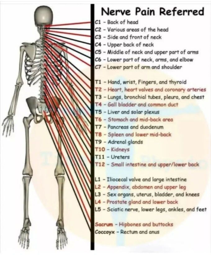 Referred Pain - MEDizzy