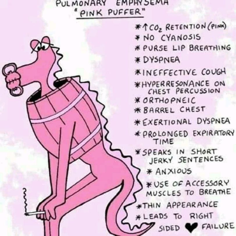 Pulmonary emphysema - MEDizzy