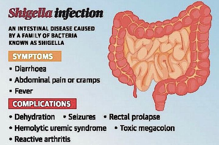 Shigella - MEDizzy