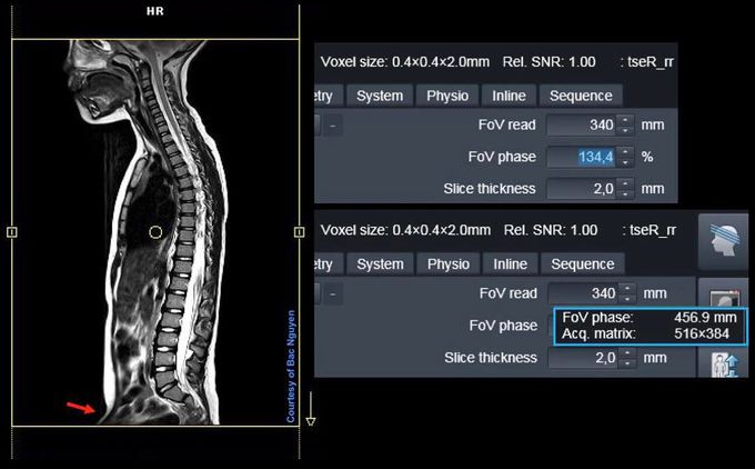 Tip of the day. Have you ever used this function? FoV PHASE - MEDizzy