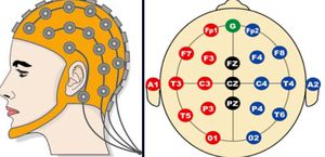 EEG electrodes! - MEDizzy