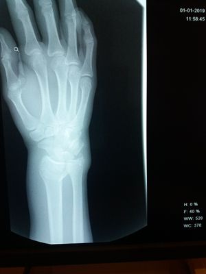 After trauma - MEDizzy