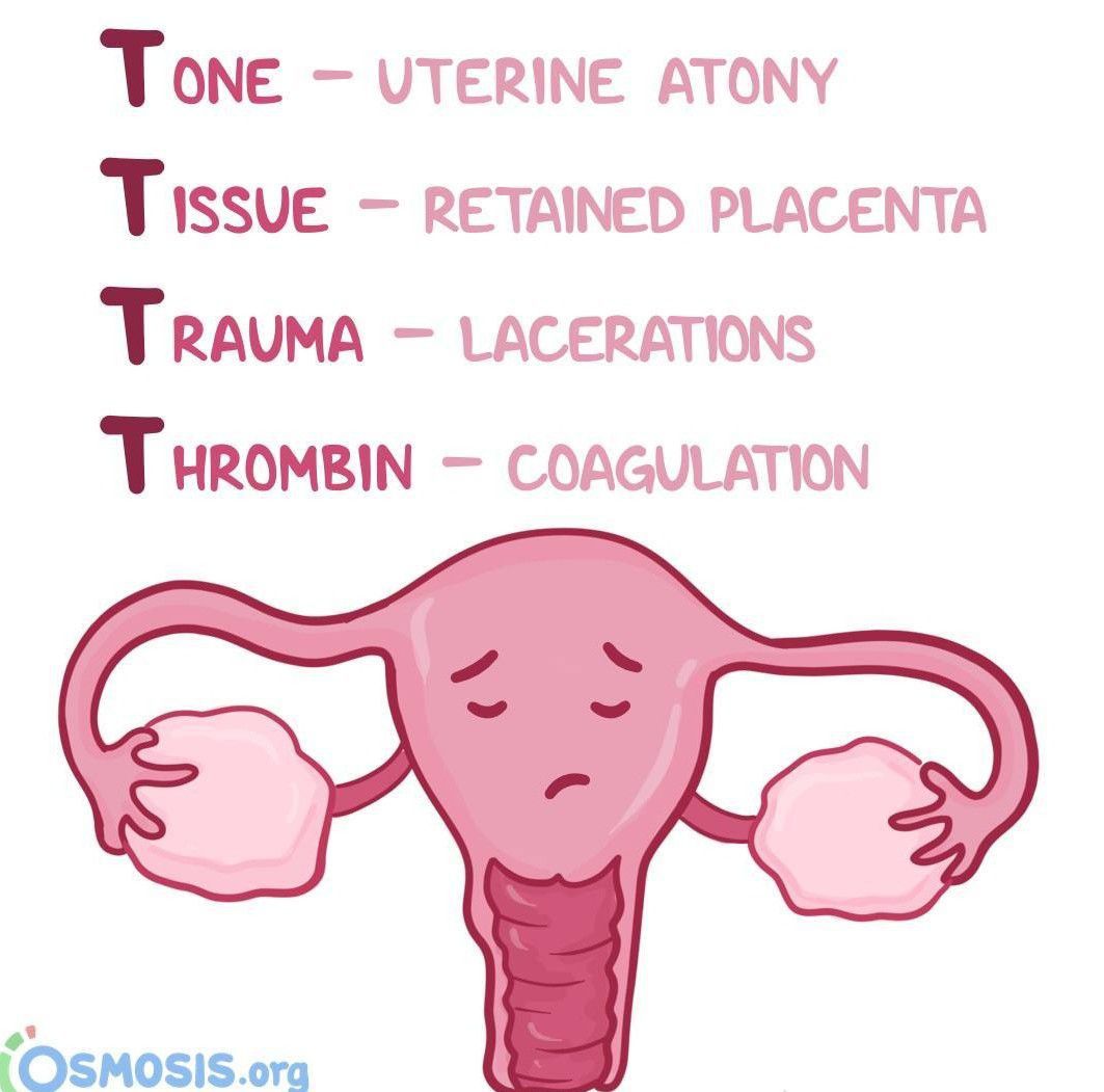 Postpartum Hemorrhage MEDizzy