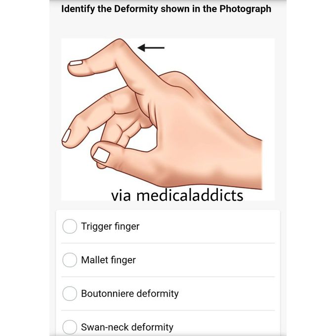 Answer published in comment section. Follow us for daily - MEDizzy