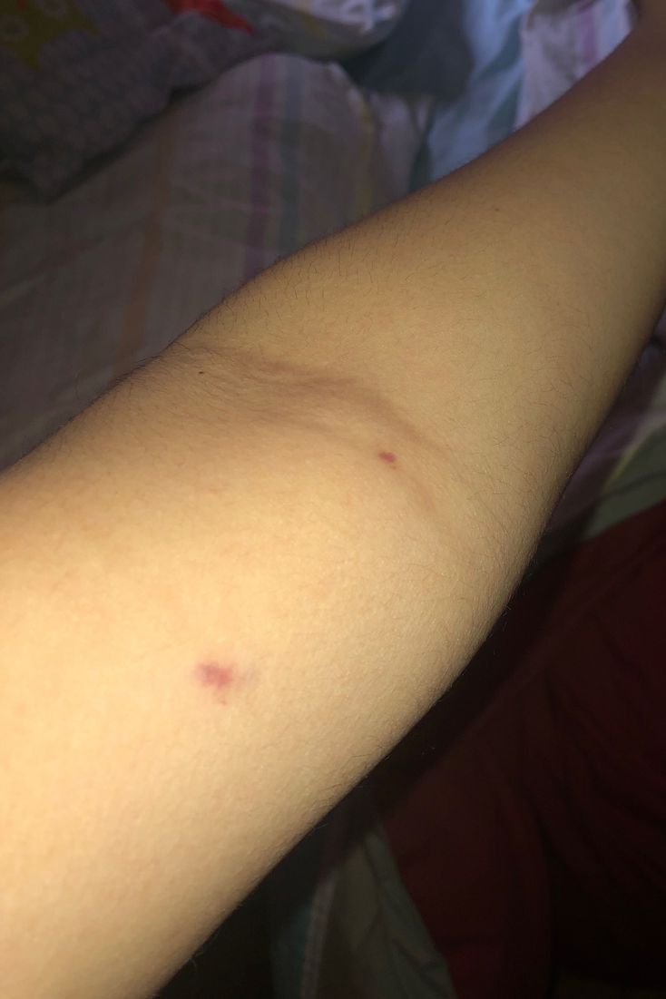 Spot on the skin! - MEDizzy