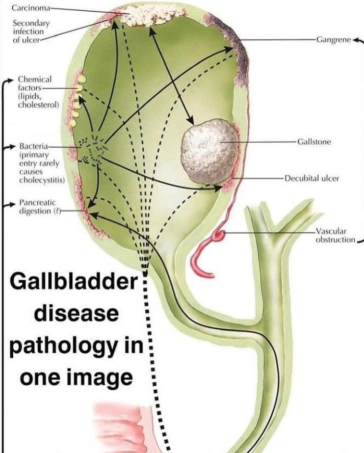 General surgery - MEDizzy