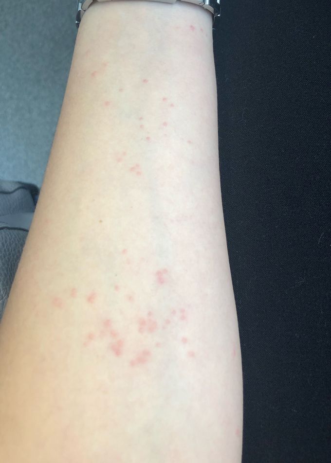 Red point on the left arm - MEDizzy