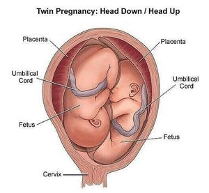 difference between vertex and cephalic presentation