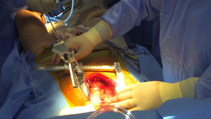 Thorax wich is prepared for surgery of heart - MEDizzy