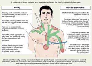 Acute pericarditis - MEDizzy