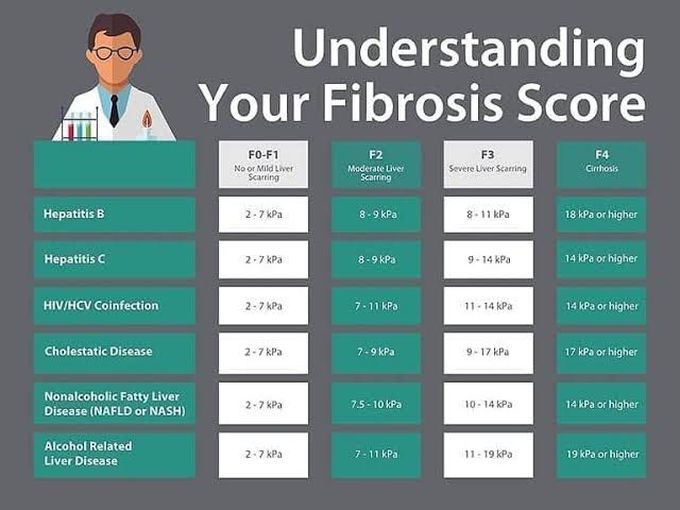 Fibrosis Score MEDizzy
