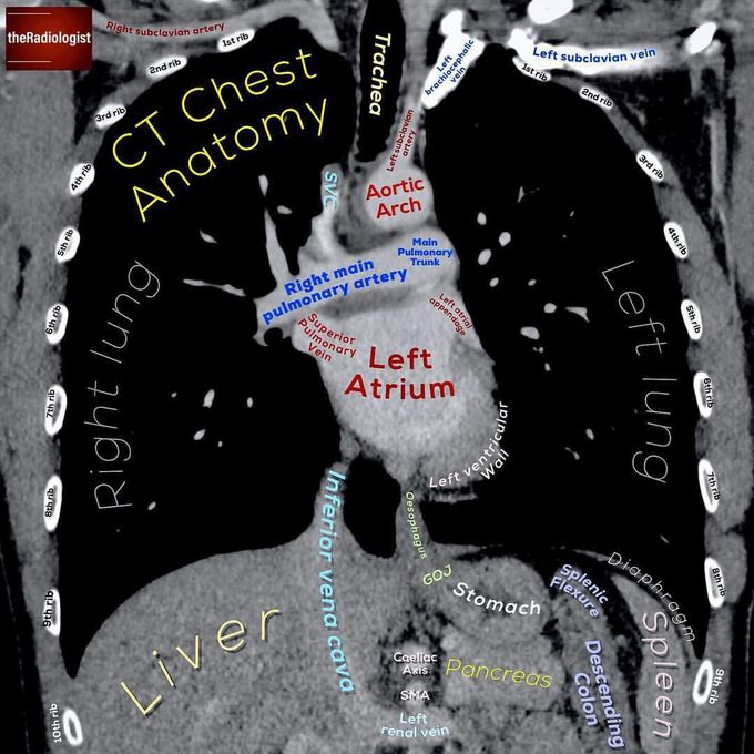 Chest CT - MEDizzy