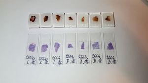 Histological thyroid tissue sample! - MEDizzy