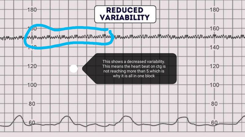 Ctg interpretation - MEDizzy