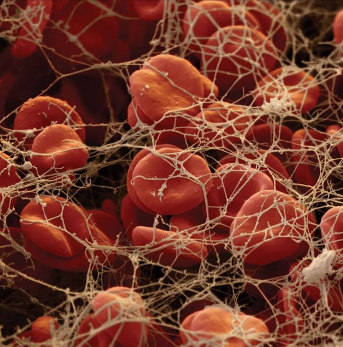 Blood clot under electron microscope - MEDizzy