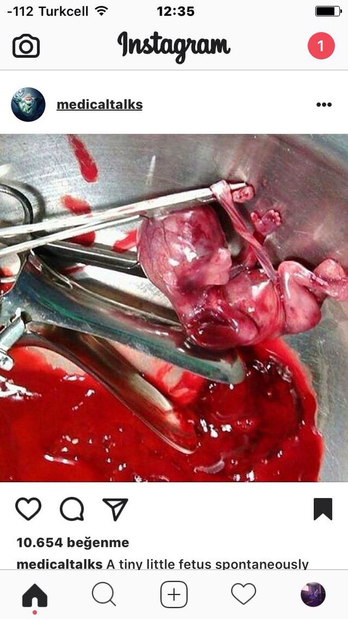 Post number 394825 - MEDizzy