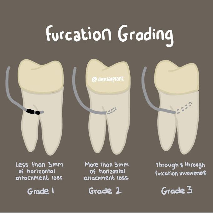 Furcation Grading MEDizzy