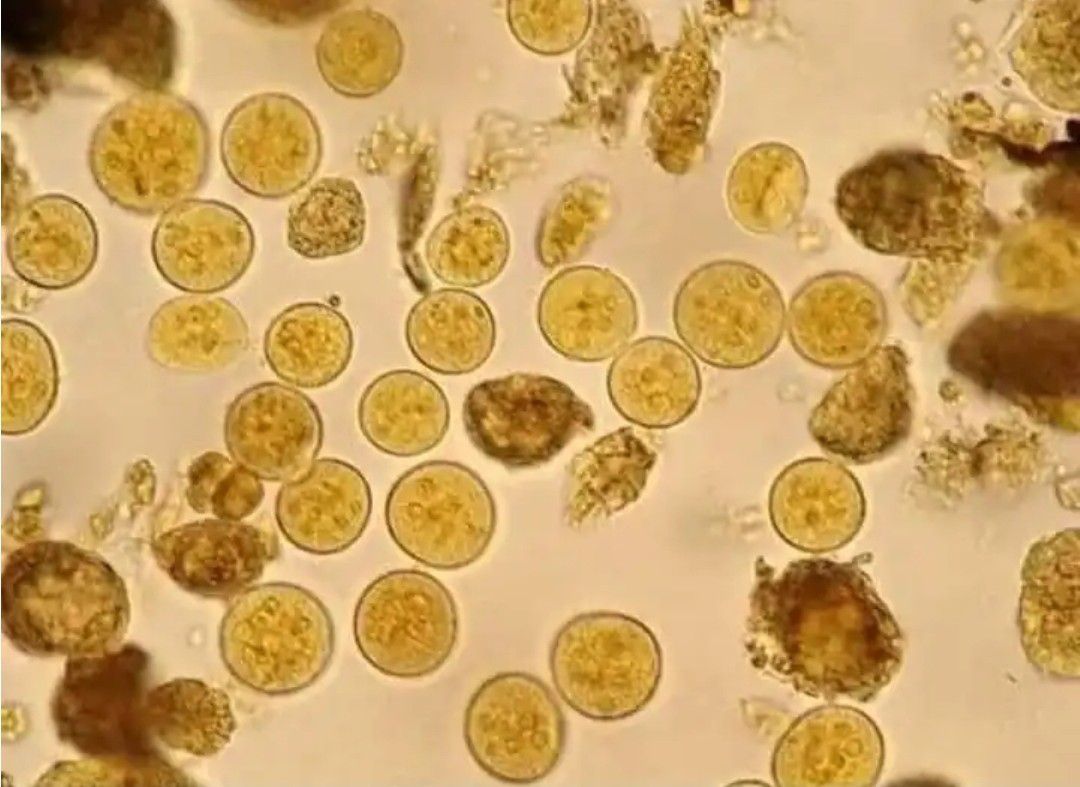 Entamoeba Coli Under Microscope Cysts And Trophozoites Of Entamoeba