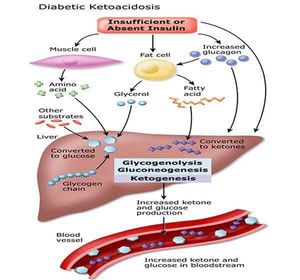 "Diabetic Katoacidosis" - MEDizzy