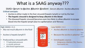 pancreatic ascites saag