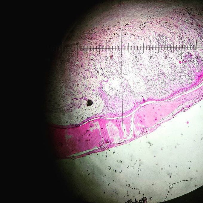 #idea #? #comment #pathology #microscope #medschool - MEDizzy
