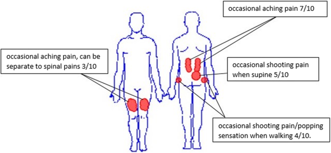 Limb–girdle muscular dystrophy - MEDizzy