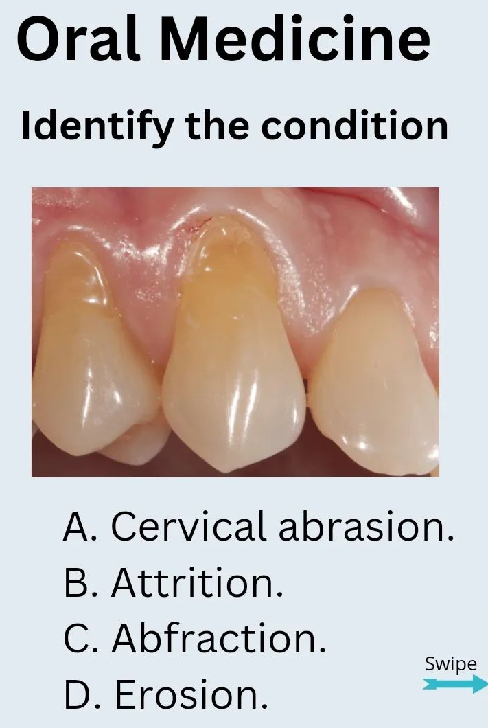 Identify the Condition - MEDizzy