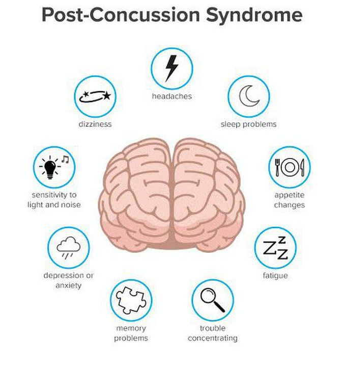 These Are The Symptoms Of Post Concussion Syndrome MEDizzy