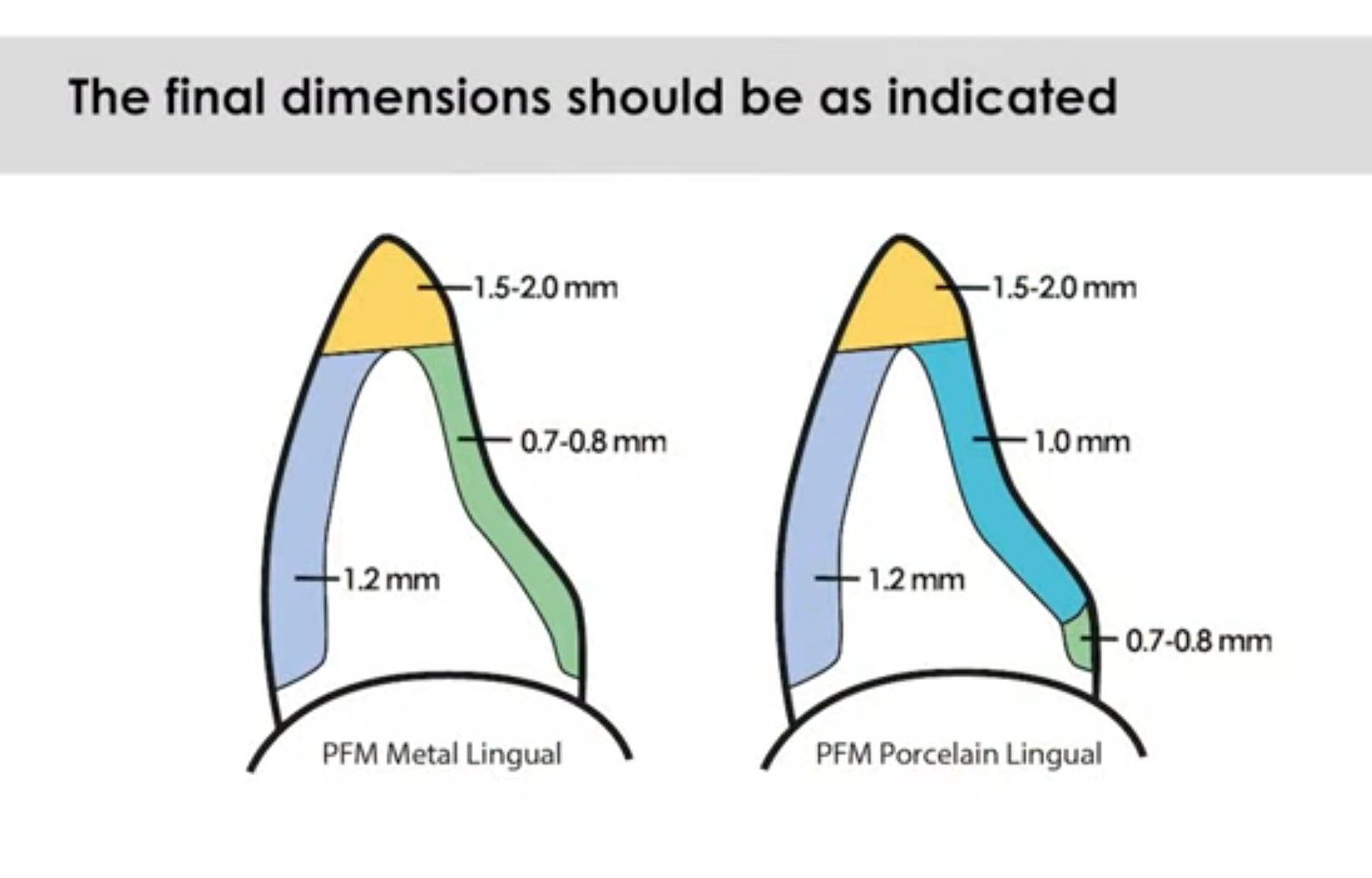 Crown Preparation Dimensions - MEDizzy