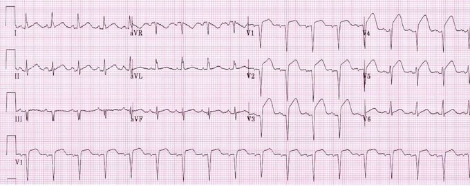 Name the vessel involved in this case?? - MEDizzy