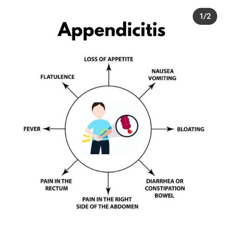 Appendicitis - MEDizzy