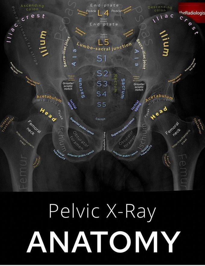 Pelvic X ray Anatomy MEDizzy