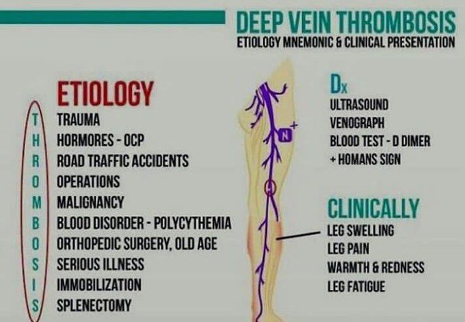 DVT - Symptoms, Causes & Diagnosis - MEDizzy