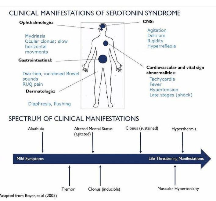 Serotonin Syndrome-Clinical Manifestations - MEDizzy