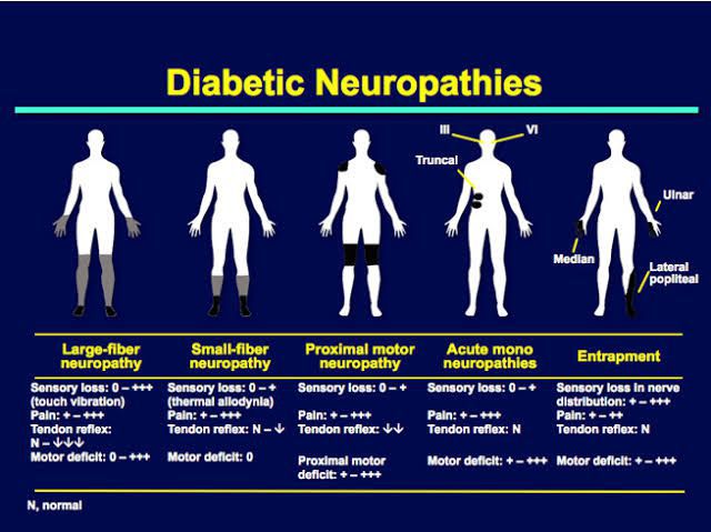 Diabetic Neuropathies - MEDizzy