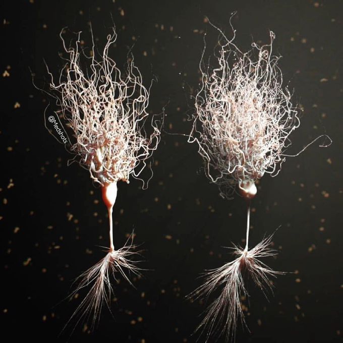 3D Model of the human neuron, the closest to be to reality! - MEDizzy