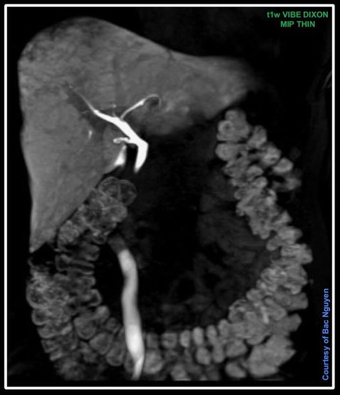 The Fine Art Of Liver Imaging with liver specific contrast - MEDizzy
