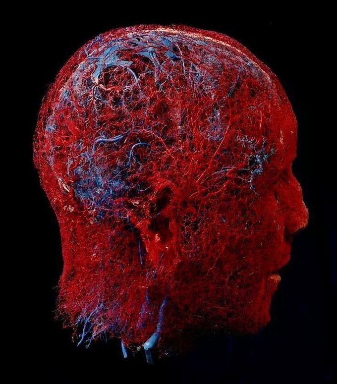 Human head with actual blood vessels - MEDizzy