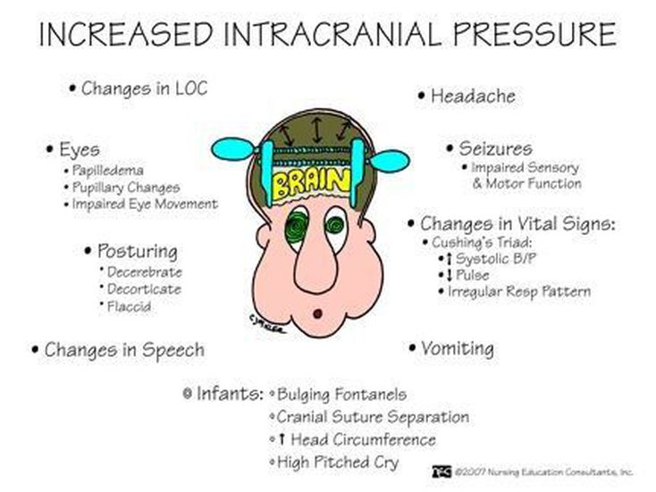 Increases ICP - MEDizzy