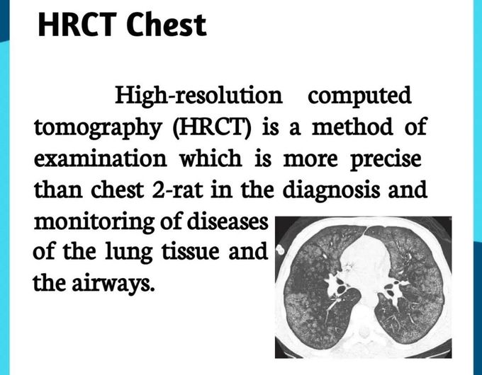 HRCT Chest - MEDizzy