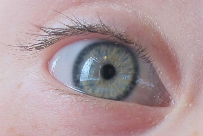 condition?? - MEDizzy