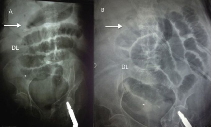 Rigler Triad - MEDizzy